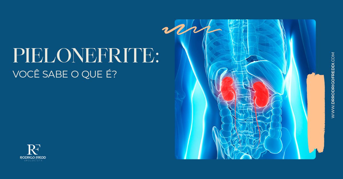 Cid Pielonefrite Não Especificada - RETOEDU
